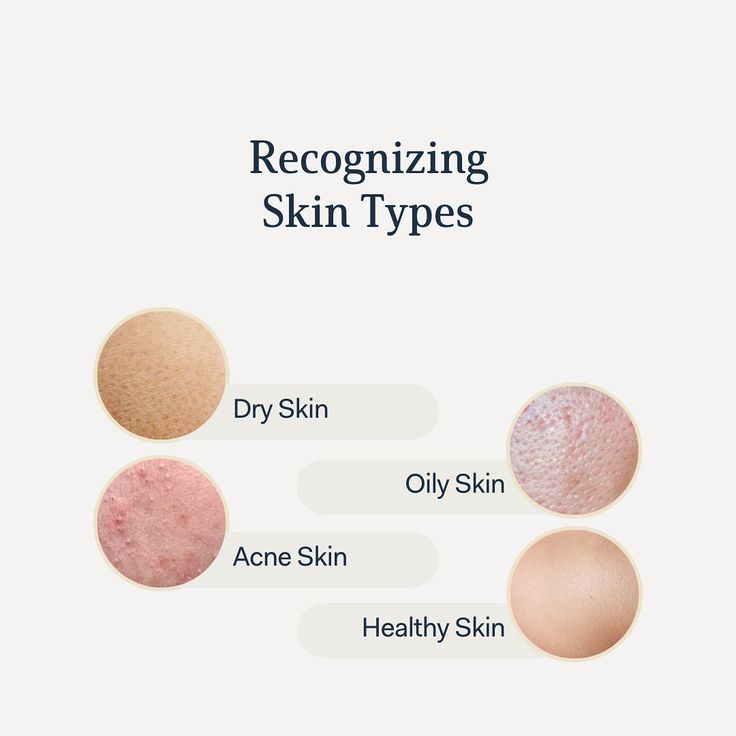 Defining Your Skin Type